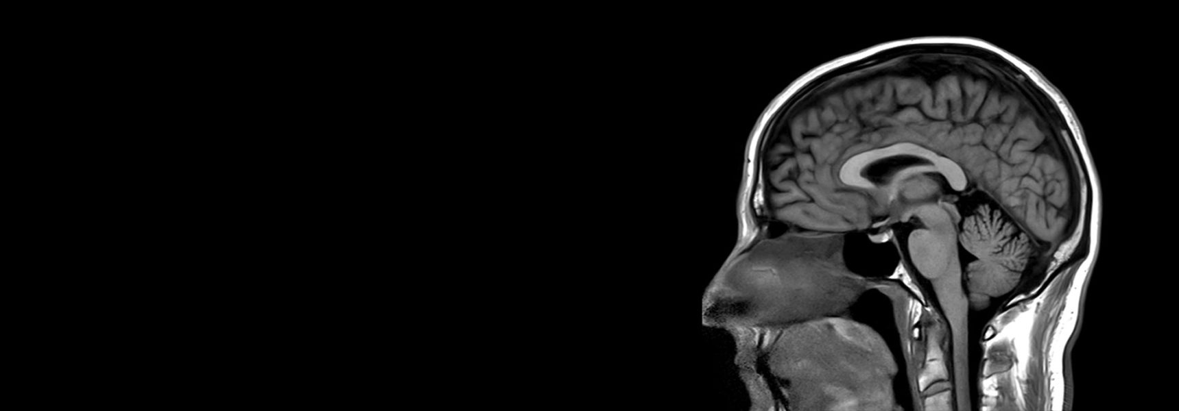 MRI Solutions for All Sizes & Budgets | Fujifilm Healthcare