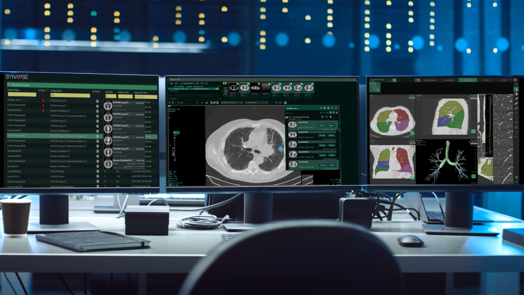 AI Orchestrator Archives - FUJIFILM Healthcare Americas Corporation