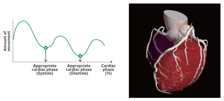 FCT iStream - FUJIFILM Healthcare Americas Corporation