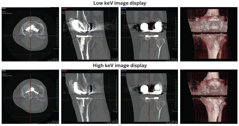 FCT iStream - FUJIFILM Healthcare Americas Corporation