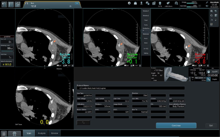 FCT iStream - FUJIFILM Healthcare Americas Corporation