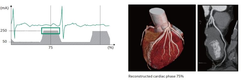 FCT iStream - FUJIFILM Healthcare Americas Corporation