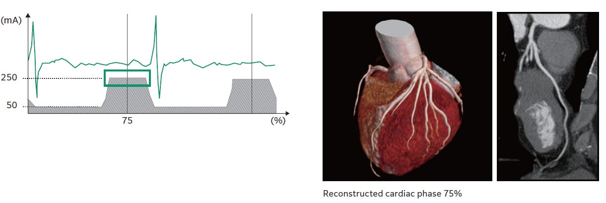 FCT iStream - FUJIFILM Healthcare Americas Corporation