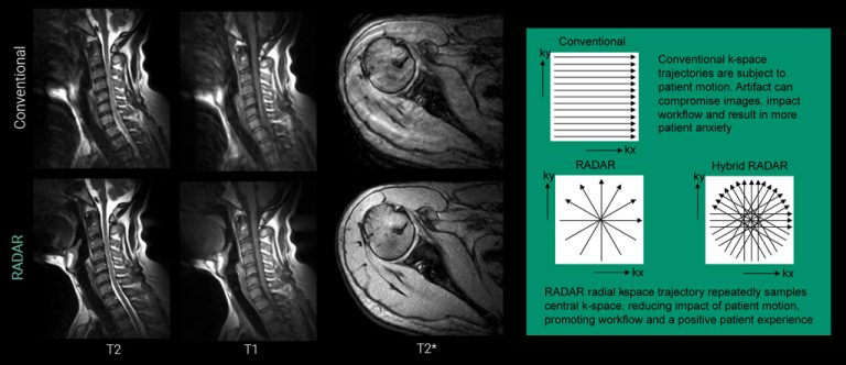 APERTO Lucent - FUJIFILM Healthcare Americas Corporation