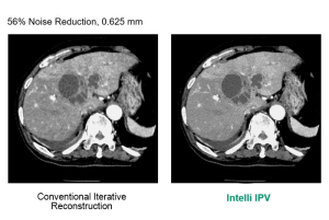 FCT iStream - FUJIFILM Healthcare Americas Corporation