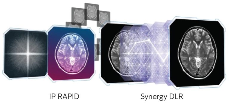 High-Field Open MRI Machines | Fujifilm Healthcare Solutions