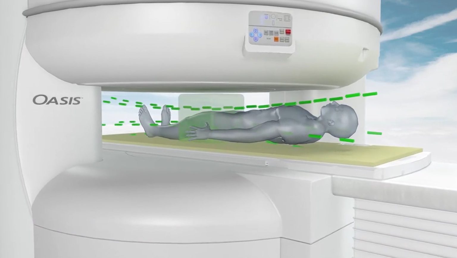 High-Field Open MRI Machines | Fujifilm Healthcare Solutions
