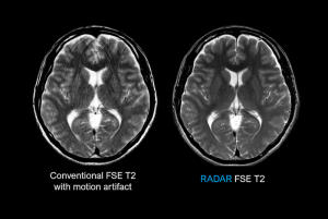 High-Field Open MRI Machines | Fujifilm Healthcare Solutions