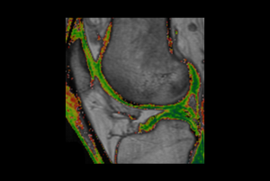 High-Field Open MRI Machines | Fujifilm Healthcare Solutions