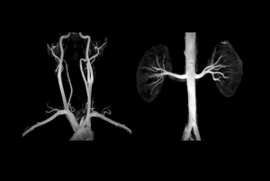 High-Field Open MRI Machines | Fujifilm Healthcare Solutions