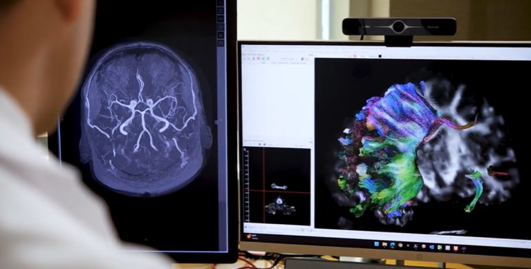 High-Field Open MRI Machines | Fujifilm Healthcare Solutions