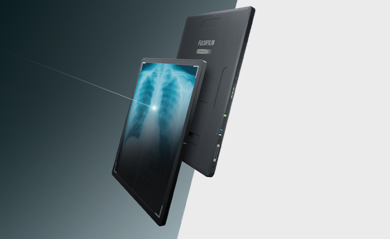 FDR ES II | Fujifilm Healthcare