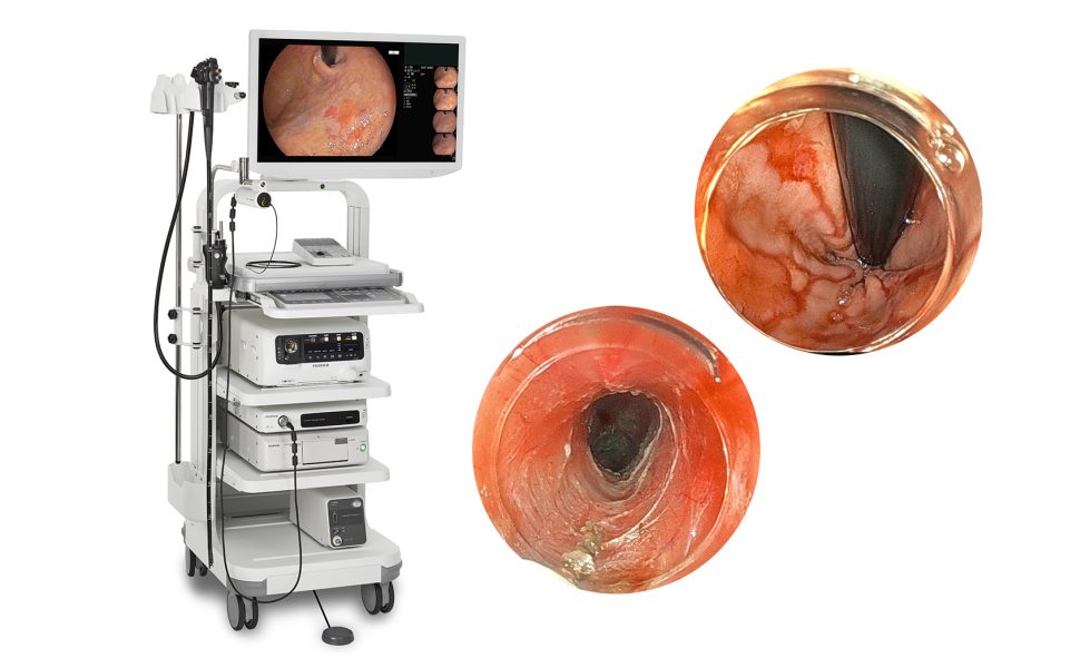 Interventional Gastro Video Imaging System | Fujifilim ELUXEO