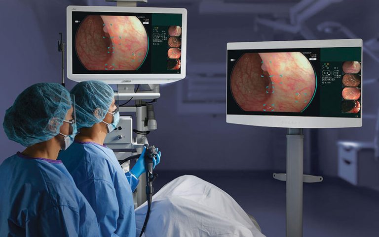 AI Raises the Bar on Colonoscopy Performance with Fujifilm’s CAD EYE ...
